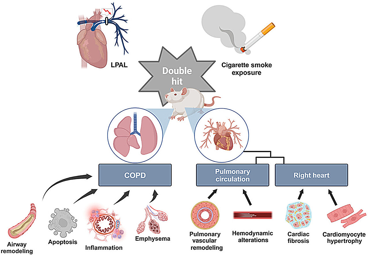 Novel rat model could advance COPD-associated cor pulmonale research