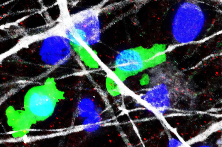 Compromised synapse-clearing ability linked to autism