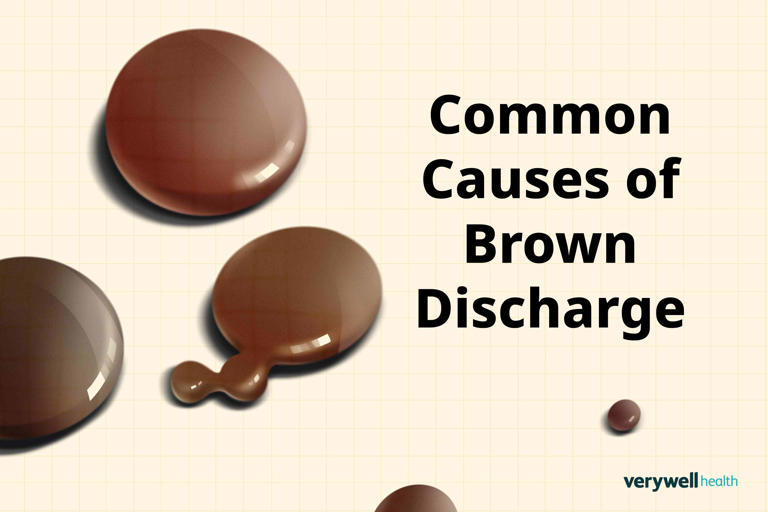 What brown discharge before your period can mean