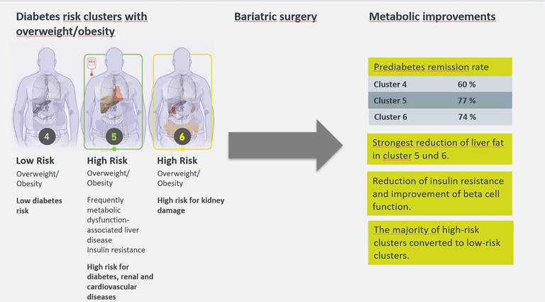 Bariatric surgery: Different benefits for people with an increased risk ...