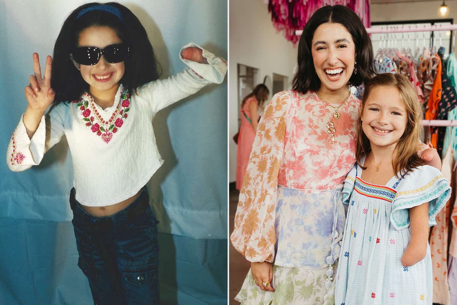 Her Limb Difference Doesn't Define Her, and She's Helping Little Girls ...