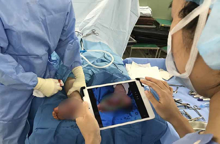 3D Infrared Camera-Based Diabetes Ulcer Healing Time Projections World ...