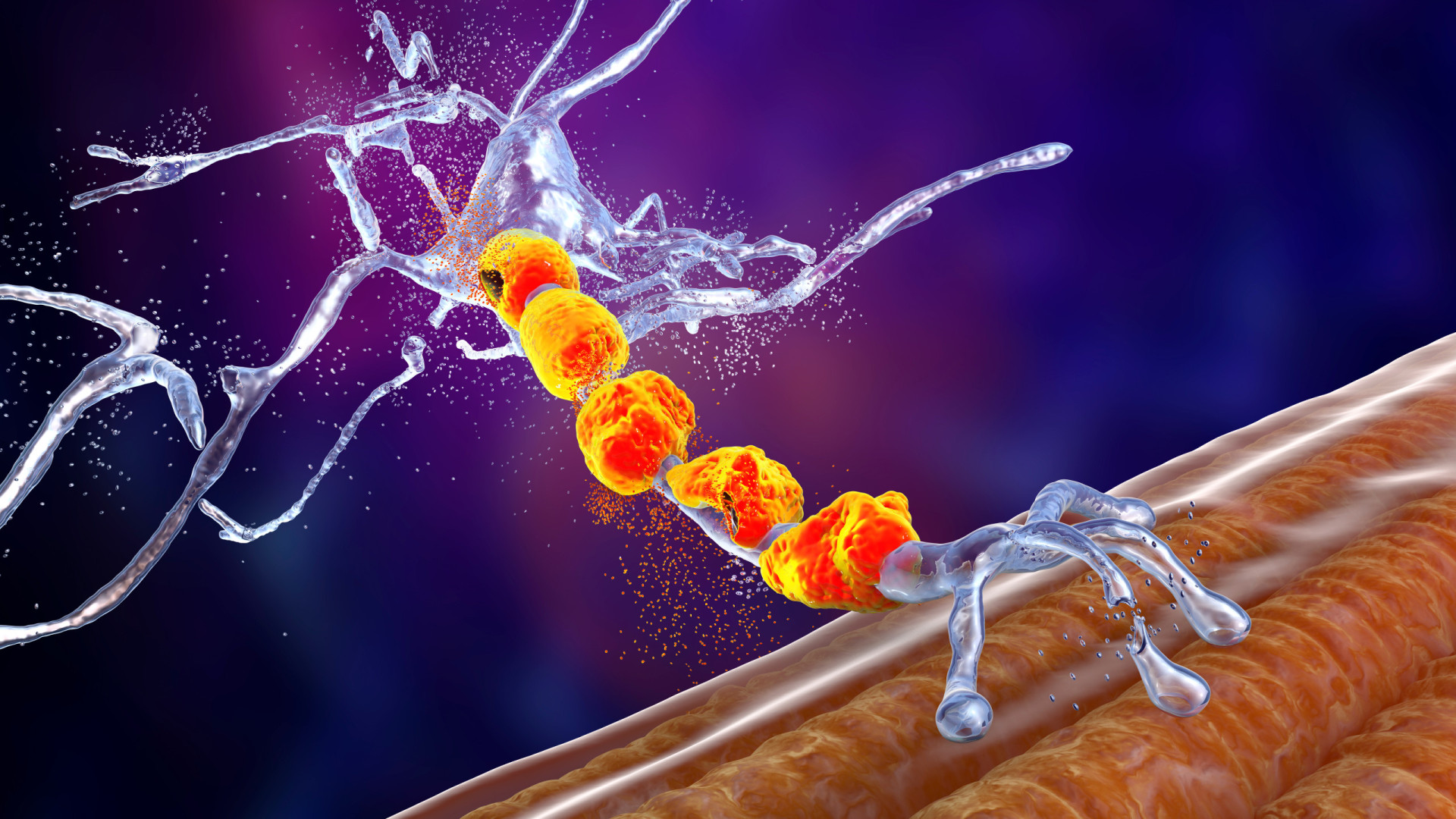 How to spot early motor neuron disease symptoms