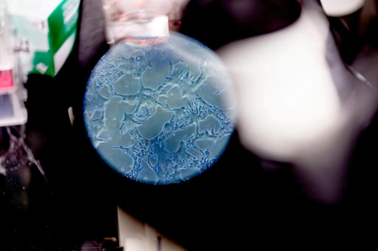 N-cadherin triggers neural stem cell differentiation: Discovery shows ...