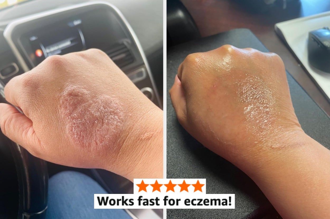 30 Problem-Solving Beauty Products For Those Issues You Didn’t Even ...