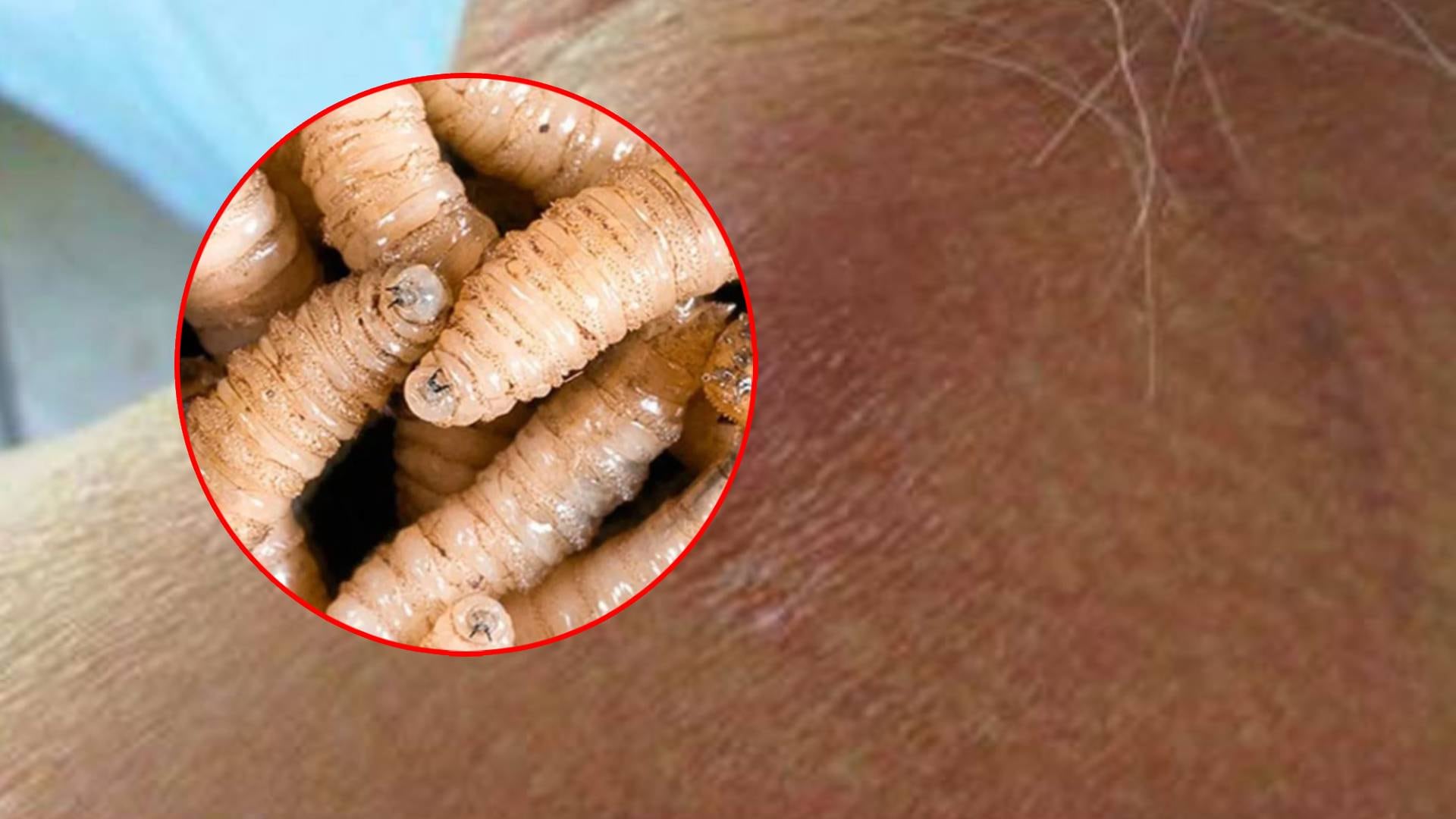 ¿Qué es la miasis? Primer caso por gusano barrenador en Chiapas alerta ...