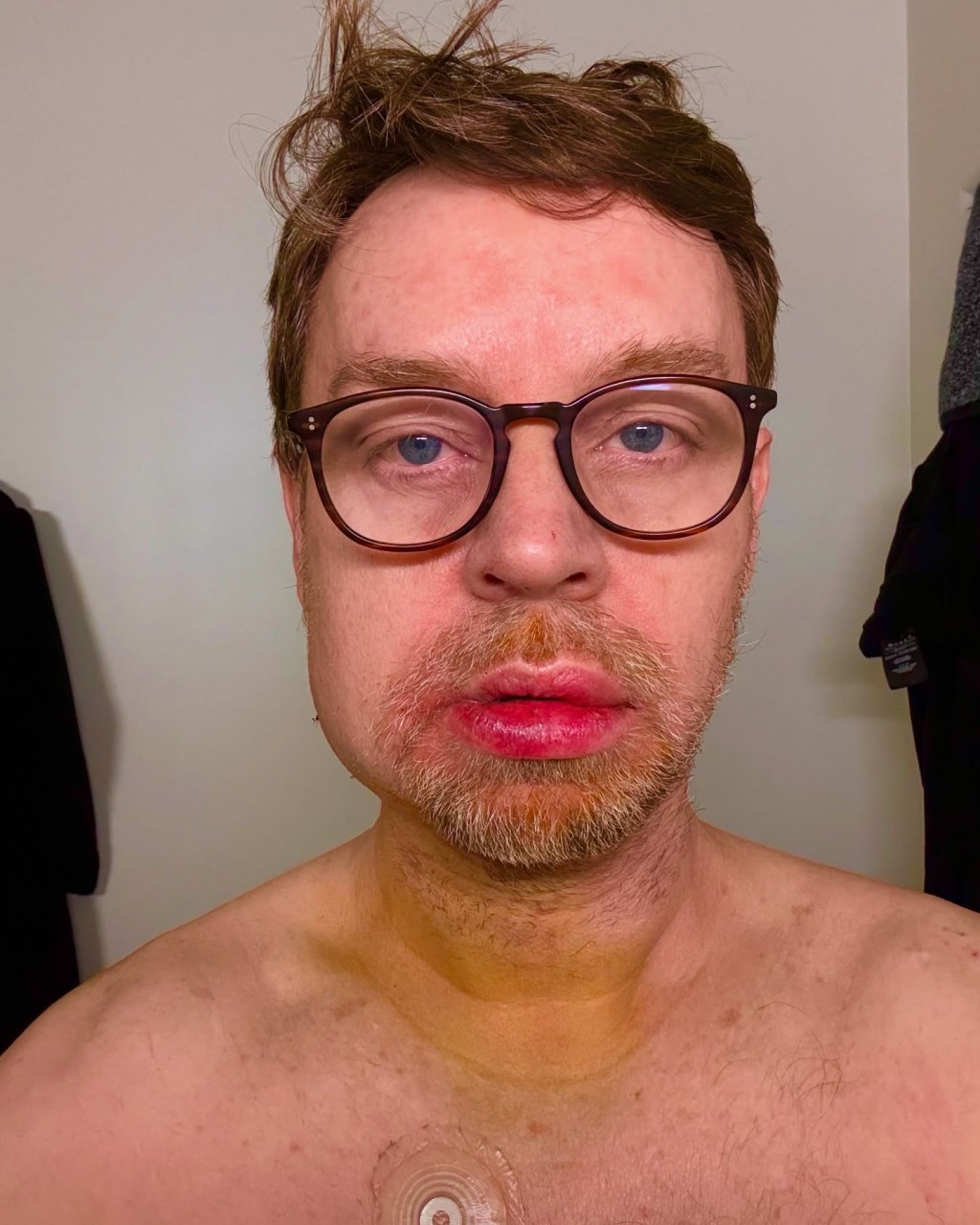 Savage Garden’s Darren Hayes broke his jaw, lost consciousness in ...