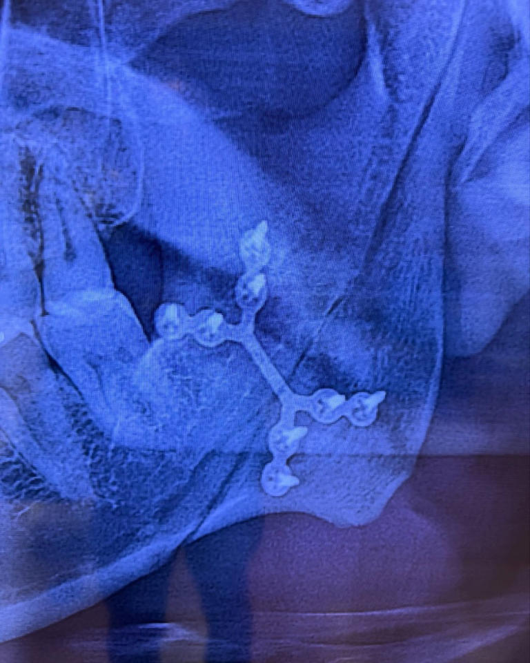 Savage Garden’s Darren Hayes broke his jaw, lost consciousness in ...