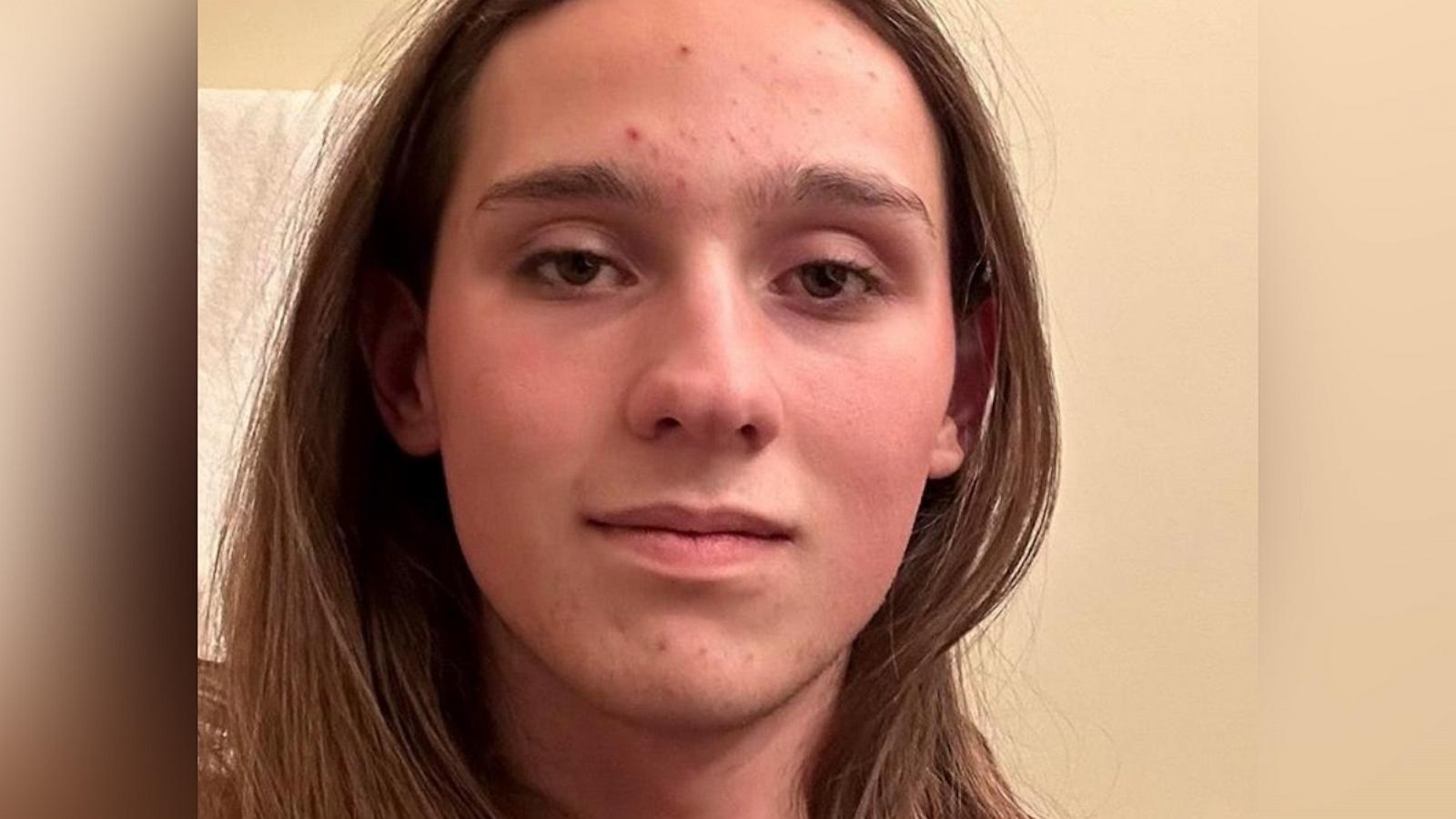 Kansas City teen arrested for alleged arson at Tesla dealership: FBI