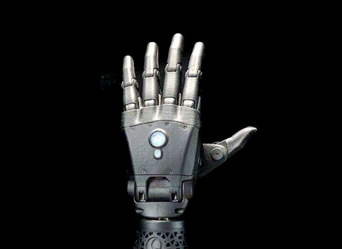 Teen's new bionic hands can literally go on solo missions