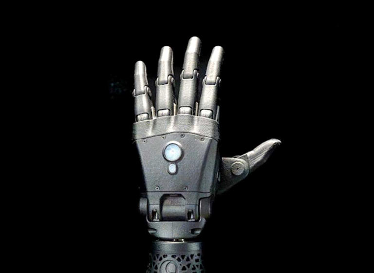 Teen's new bionic hands can literally go on solo missions