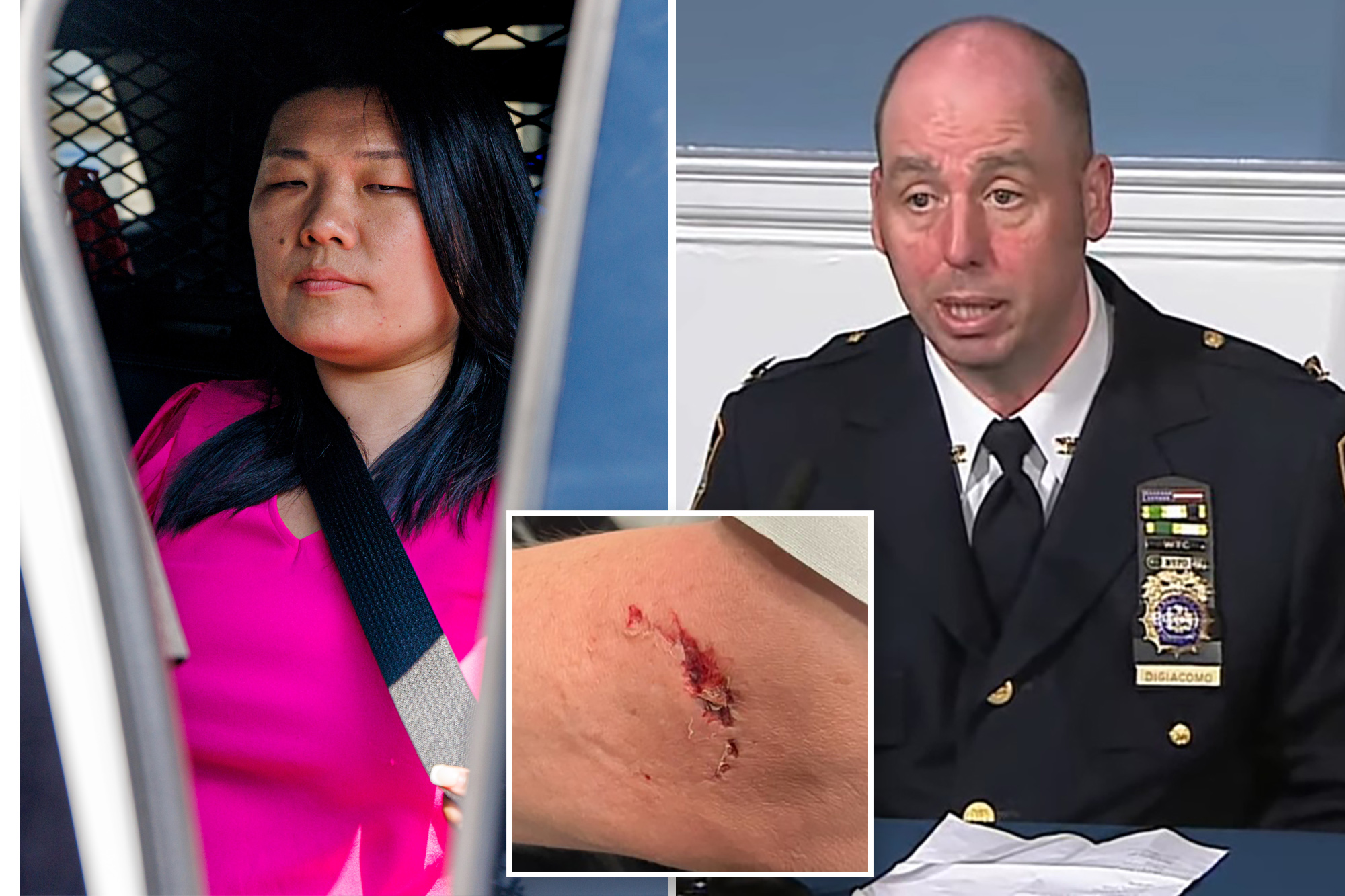 NYPD chief suing NYC councilwoman who bit him at protest, despite ...