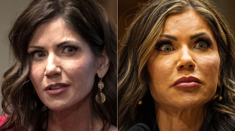 How Kristi Noem's Face Has Transformed Over The Years, According To Our ...