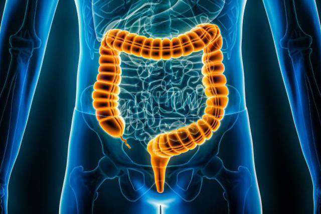 ¿Qué se siente cuando tiene el colon inflamado? Así puede identificar