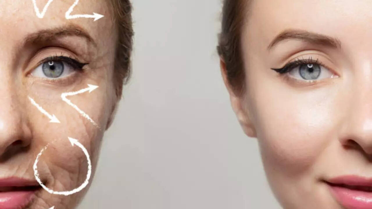 Skin tightening in 2025: What's trending and what actually works?