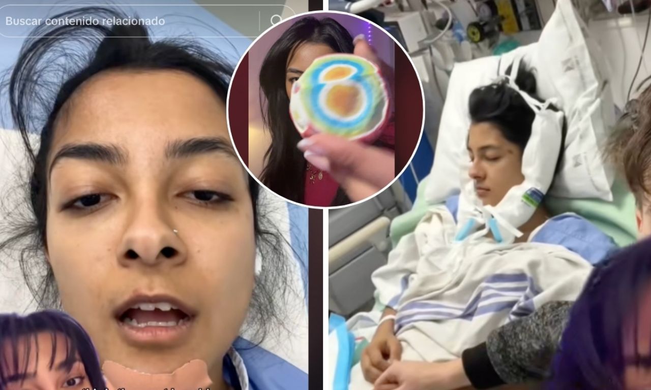 Mujer se come un famoso dulce y termina con la mandíbula toda ...