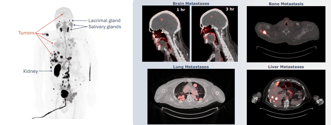 Breakthrough mini-protein revolutionizes how we treat cancer