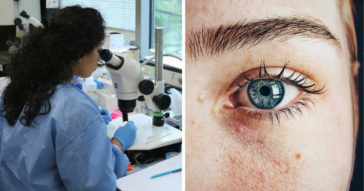 Scientists Discover a Brand New Color ‘Olo’ During Retina Simulation ...