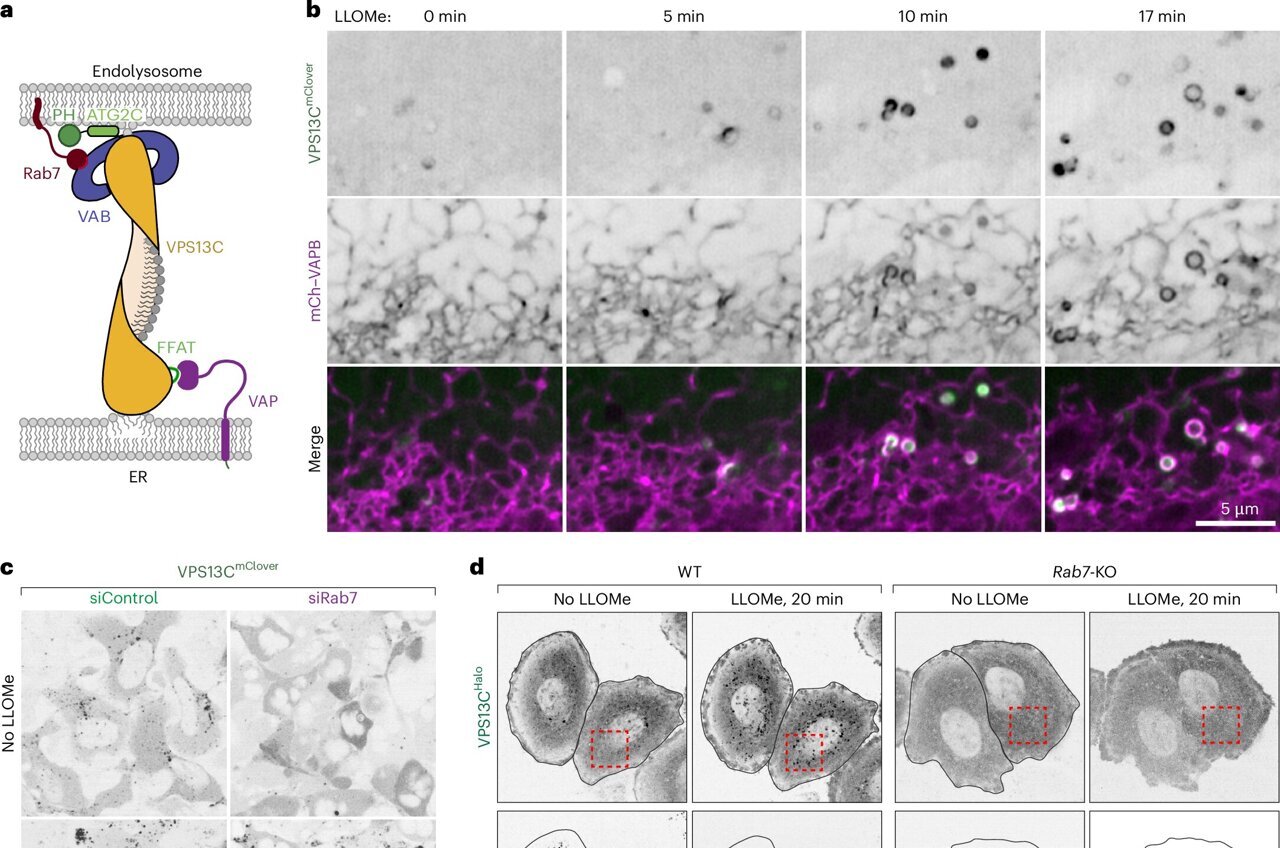 Damaged cell 'trash cans' may contribute to Parkinson's disease