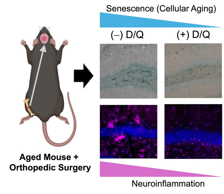 Mouse study links senescent cells to post-surgical delirium in elderly