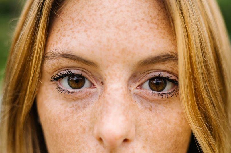 Lesser-known eye symptom could mean you have undiagnosed diabetes