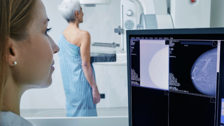 Women Are More Comfortable With AI-Assisted Mammography