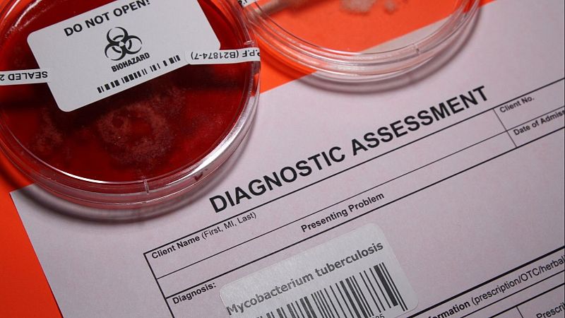 European countries are falling short on fight against HIV, TB and STIs ...