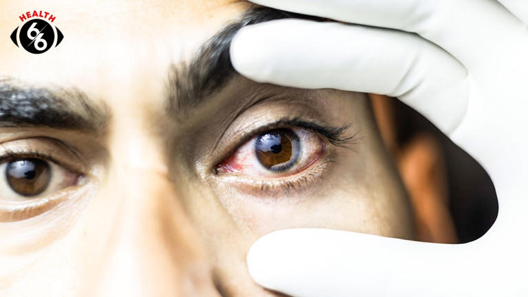 India carries high burden of eye cancer: How to recognise early signs