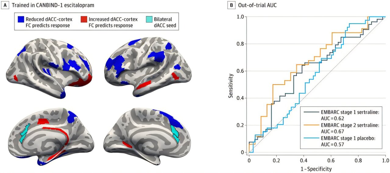Brain connectivity patterns help predict antidepressant response in ...
