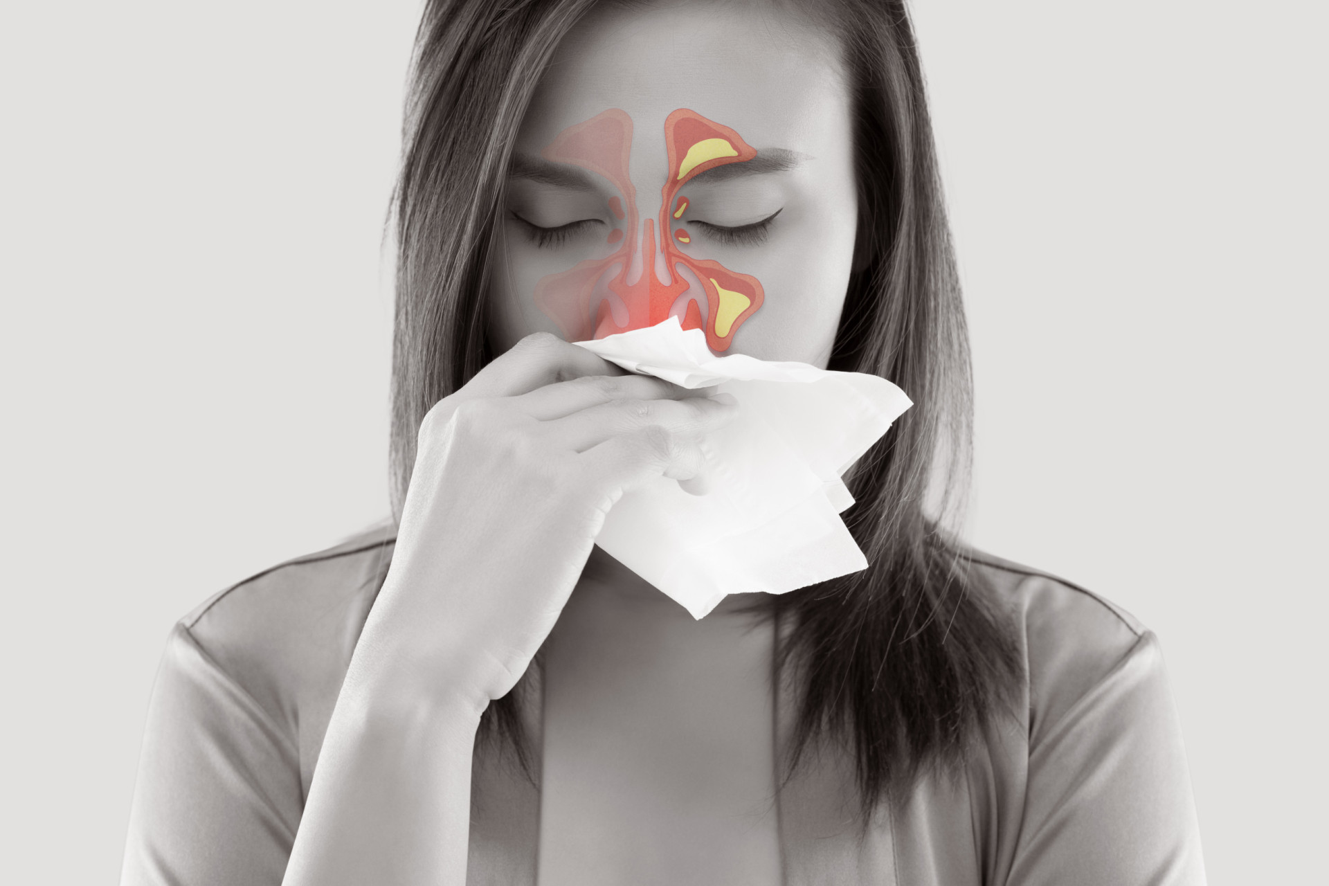 Sinus, cold, or allergies? How to tell them apart