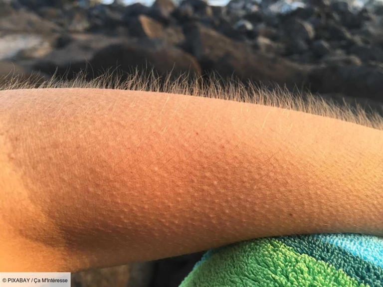 Pourquoi avons-nous la chair de poule