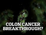 Study links common food bug in childhood to a rise in colon cancer