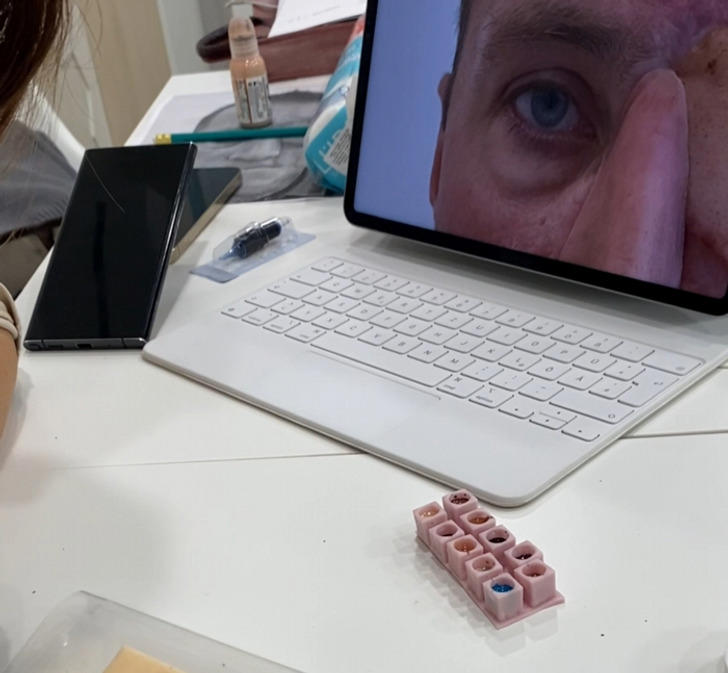 Tattoo Artist Turns Pain Into Art With Hyper-Realistic Eye Tattoo for ...