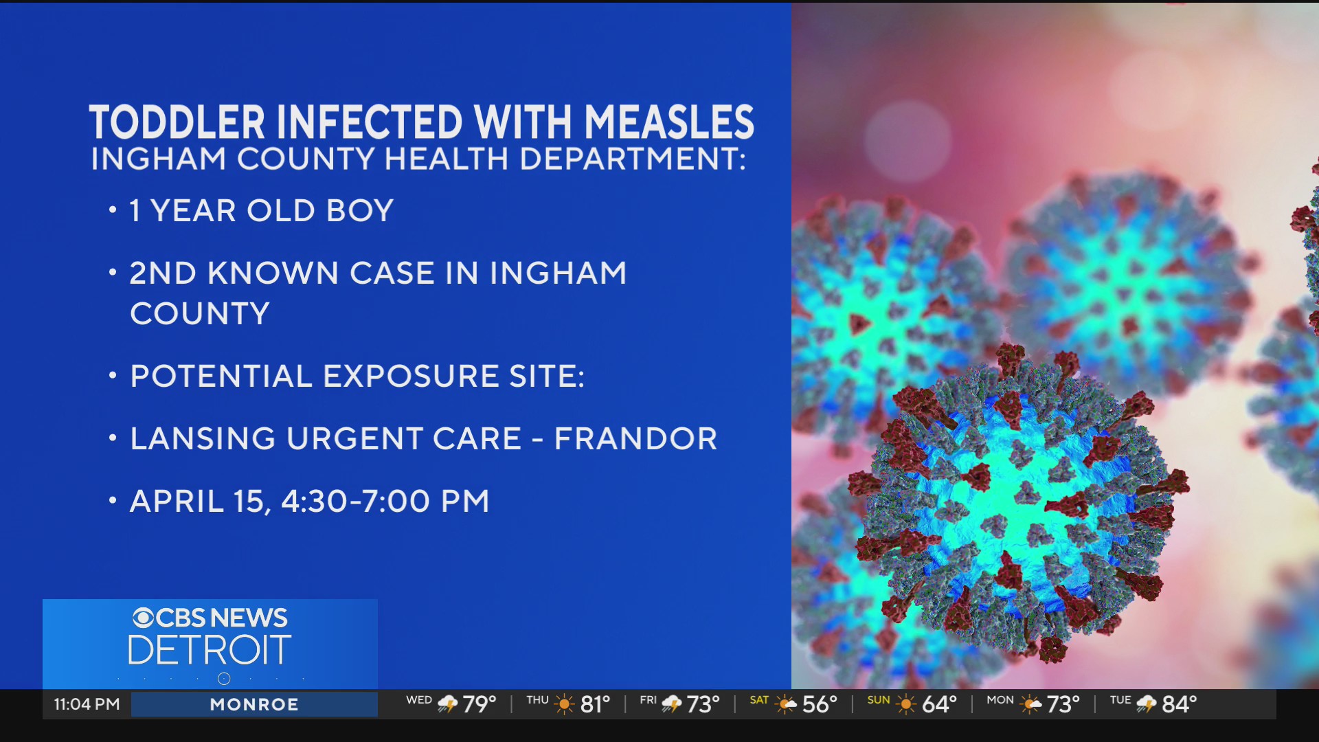 Second measles case confirmed in Ingham County