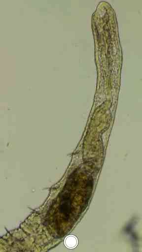 Phantom Sprinkles: Unveiling the Mystery Under the Microscope!