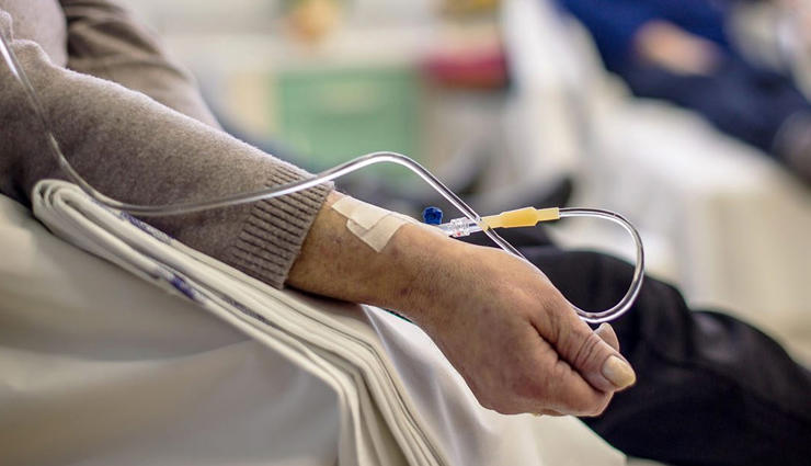 15 Major Side Effects of Chemotherapy