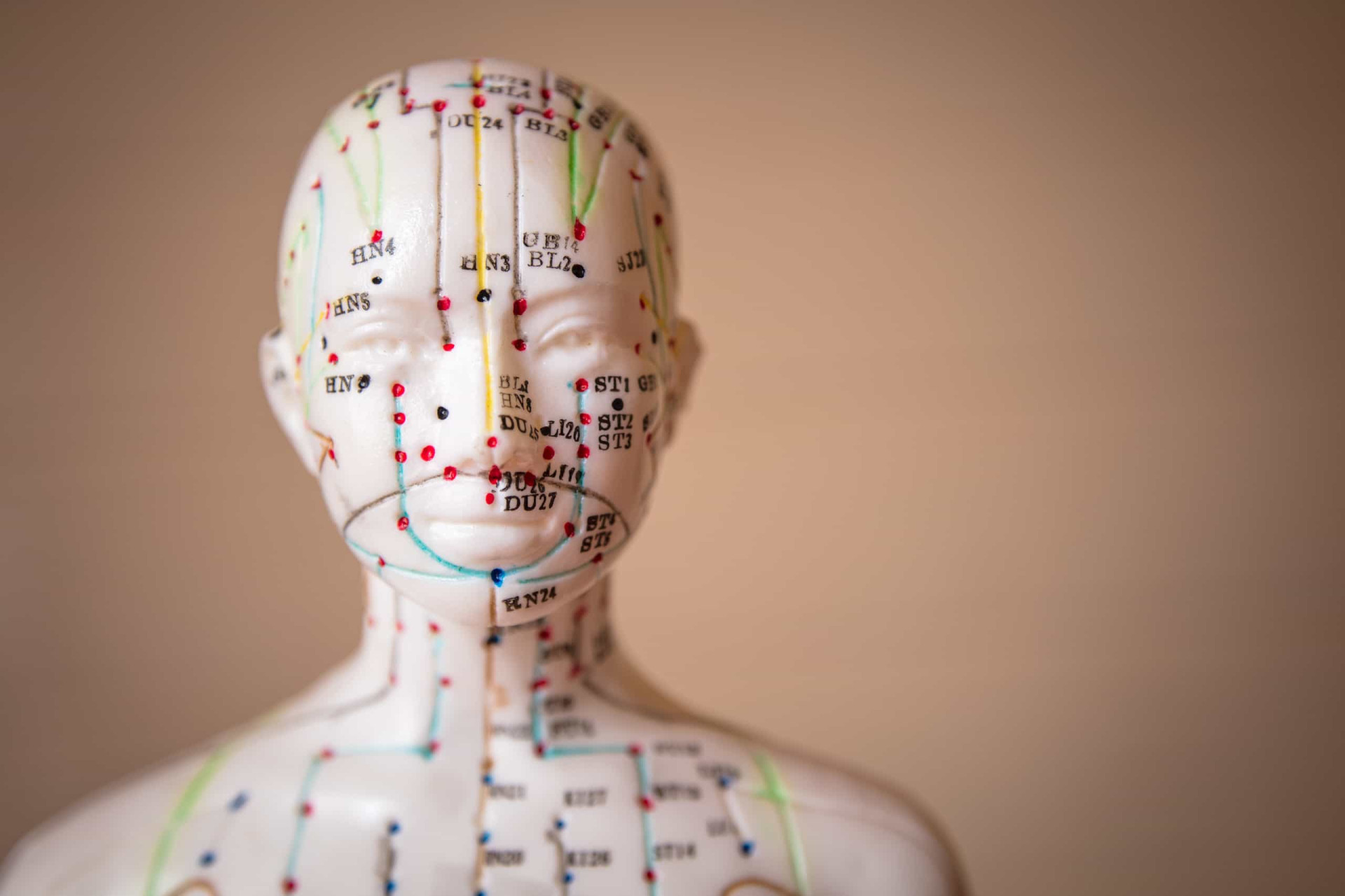How acupuncture is changing modern medicine