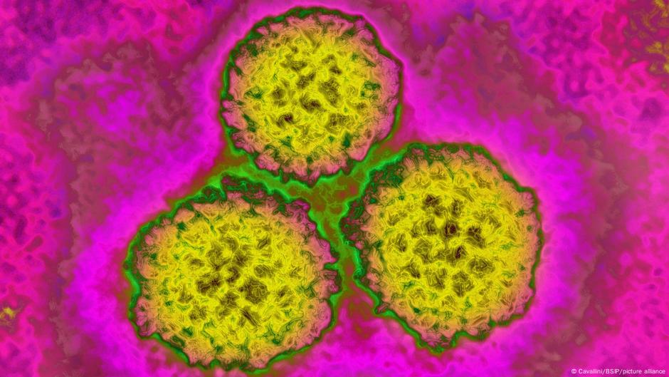 World Cancer Day: Smoking, infections and alcohol cause 4 in 10 ...