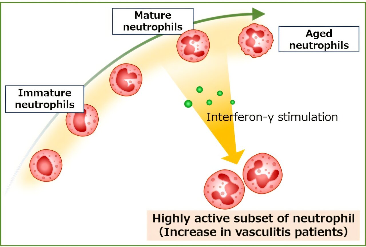 Certain neutrophil subtypes may signal relapse risk in autoimmune blood ...