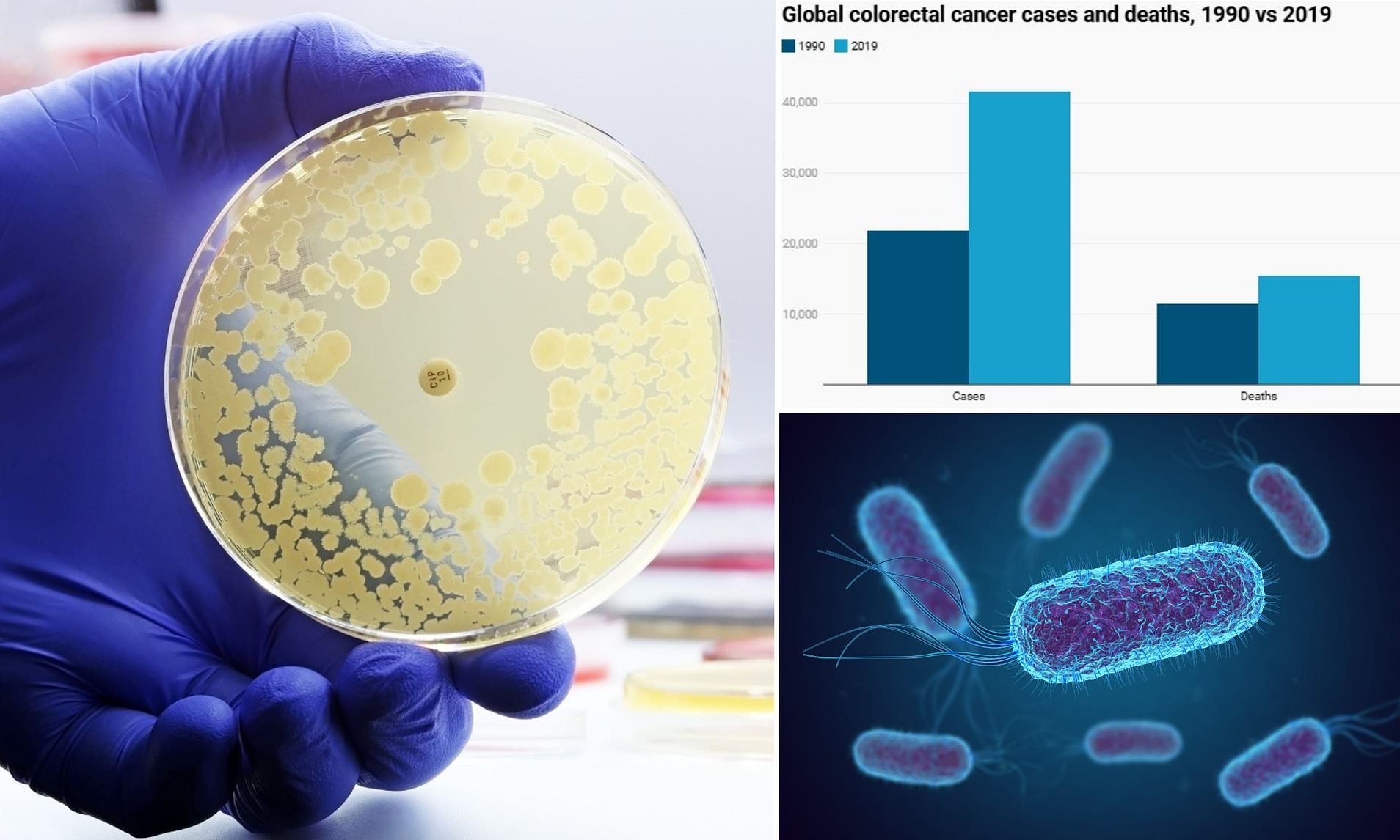 Surge in bug linked to tainted SALAD may explain colon cancer in young ...