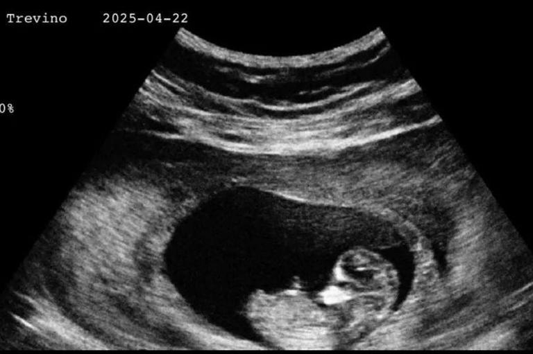 All about Ash Trevino - the recently 'pregnant' TikTok influencer under ...