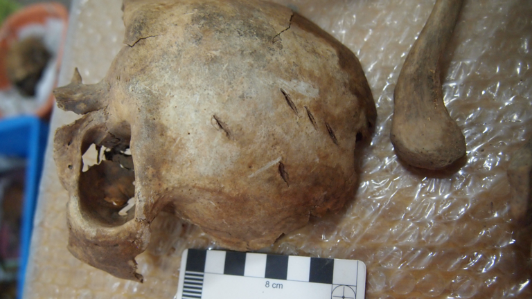 18 stab wounds to 3,700-year-old skull reveal fierce feuding in ancient China
