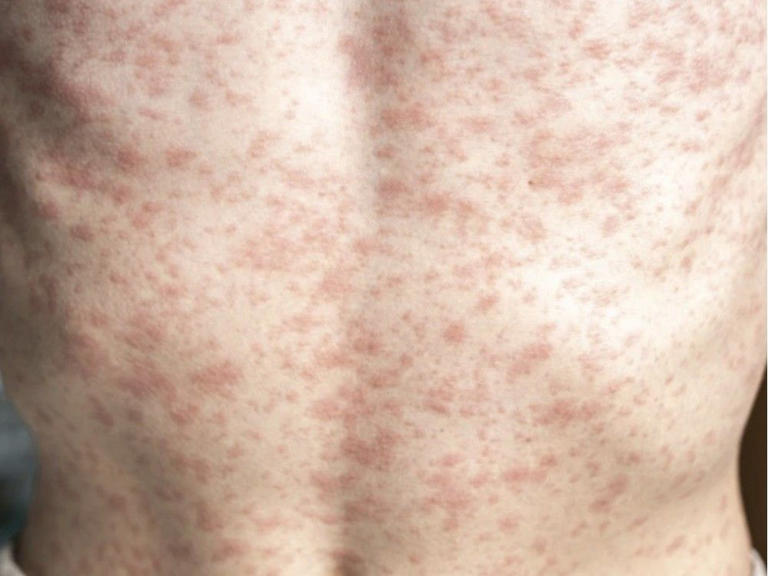 Did you visit Food Basics or Costco last week? Ottawa health unit warns ...