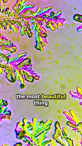 Real-Time Tear Crystallization Under the Microscope