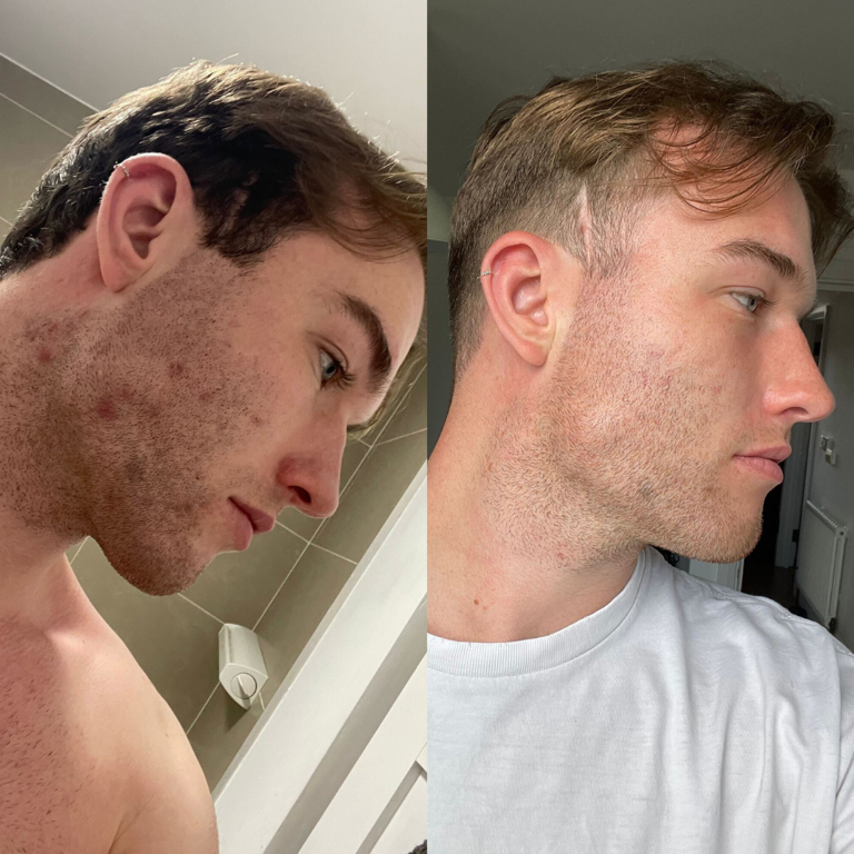 Silver serum sensation: The new skincare revolution