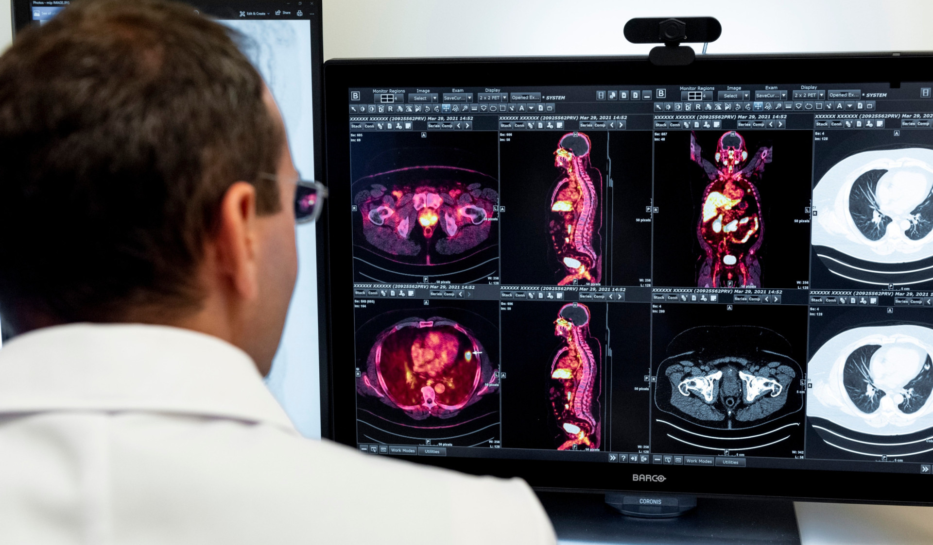 Why cancer risk increases with old age