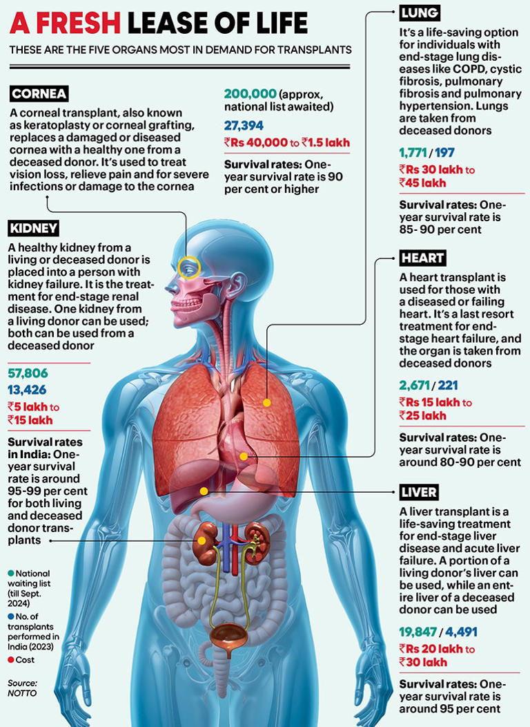 Organ transplants | A dire donor shortage