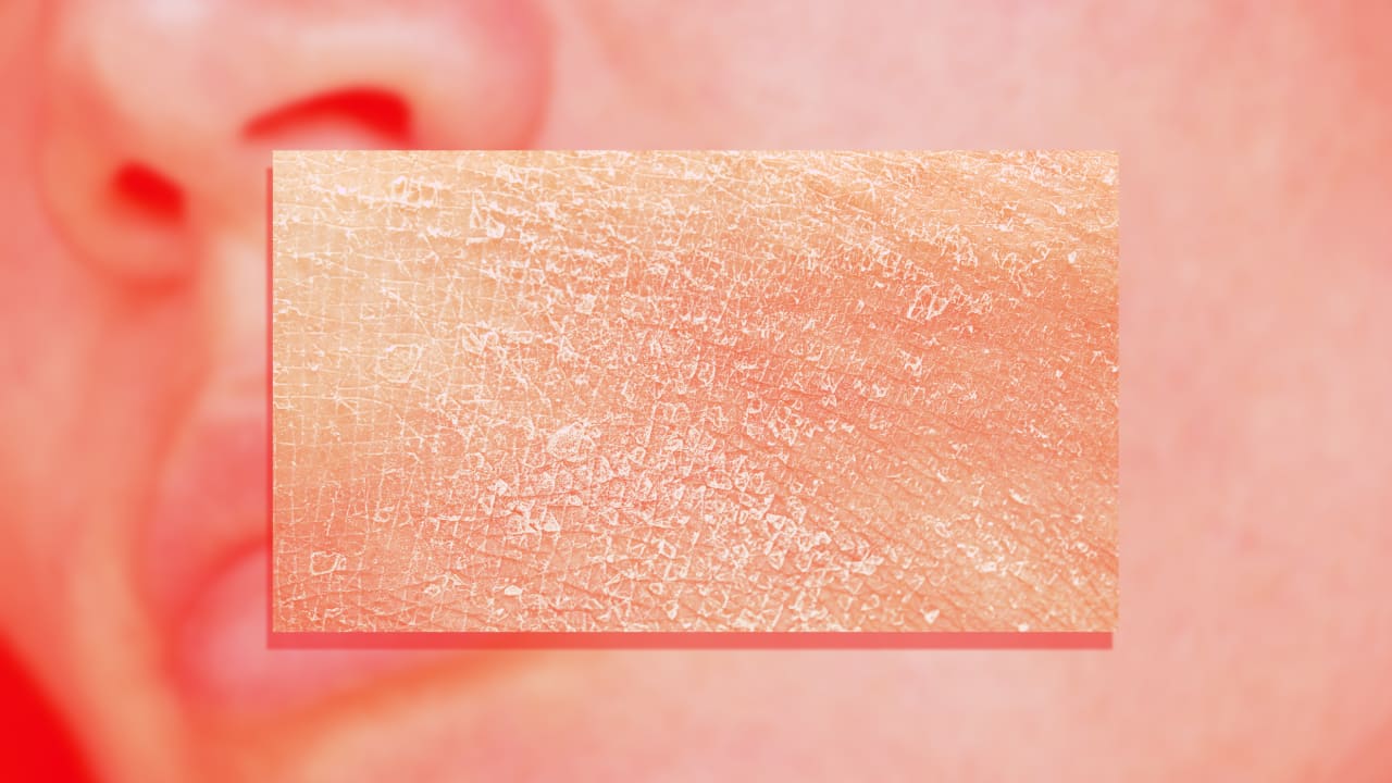 The ‘Caveman Method’ is the latest viral skincare technique. Experts ...