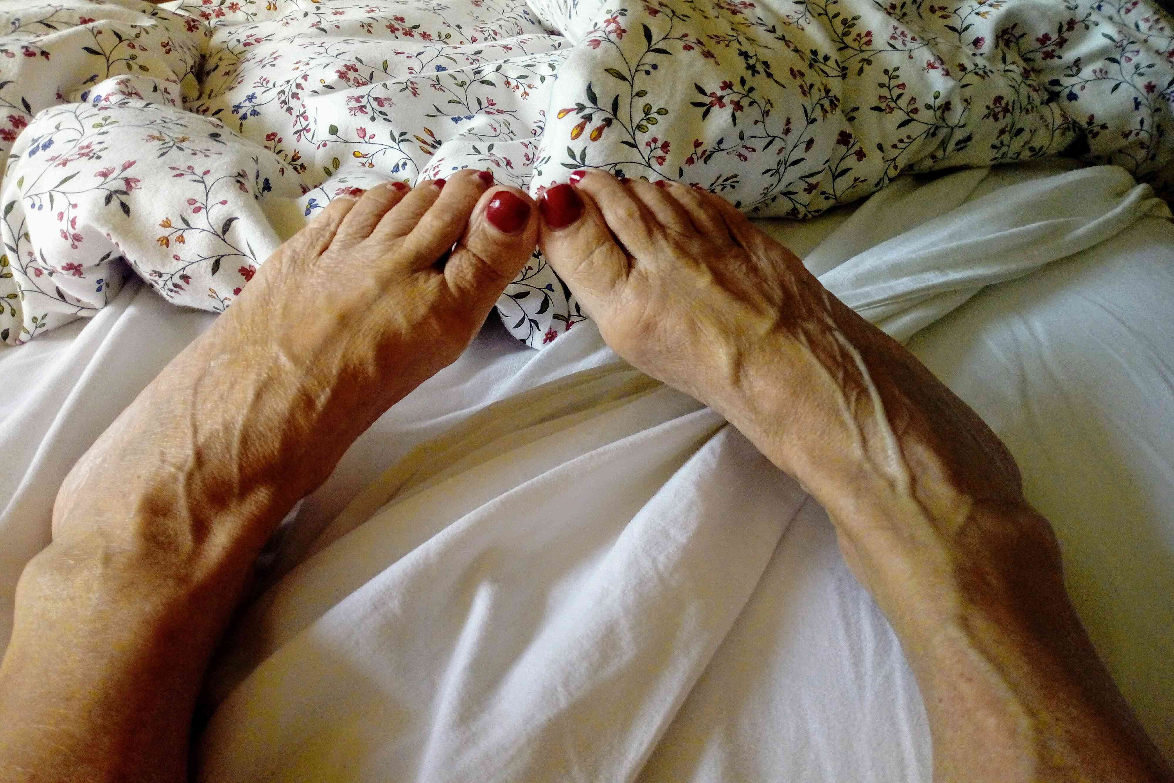 Protecting your feet from Ozempic side effects