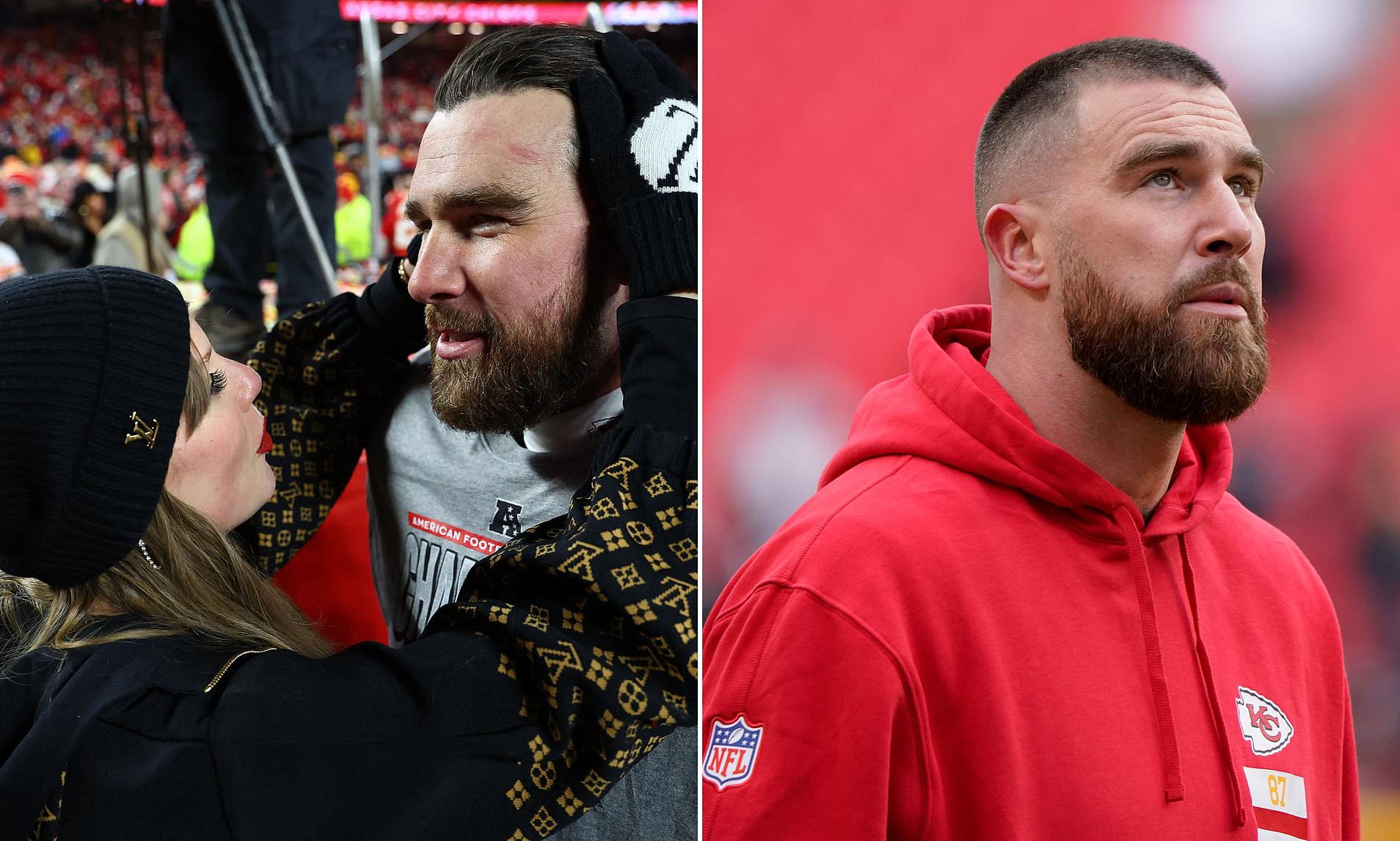 Travis Kelce's barber reveals if the Kansas City Chiefs star has had a ...